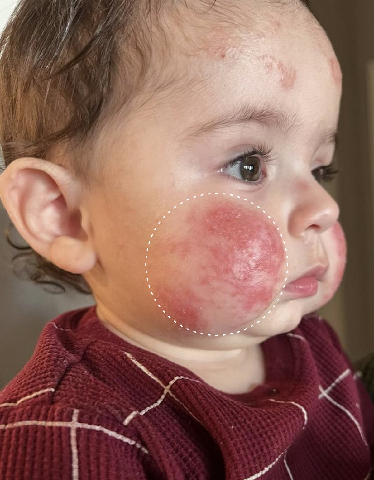 Magic Molecule | The magical all-over healing solution