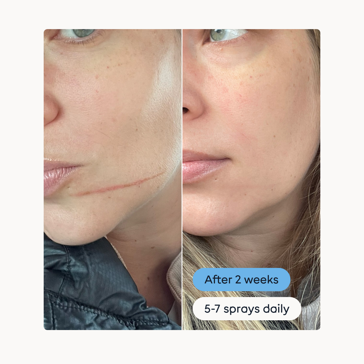 Magic Molecule | Hypochlorous Acid Solution