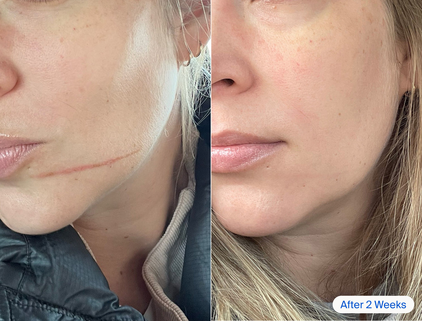 Magic Molecule | The magical all-over healing solution