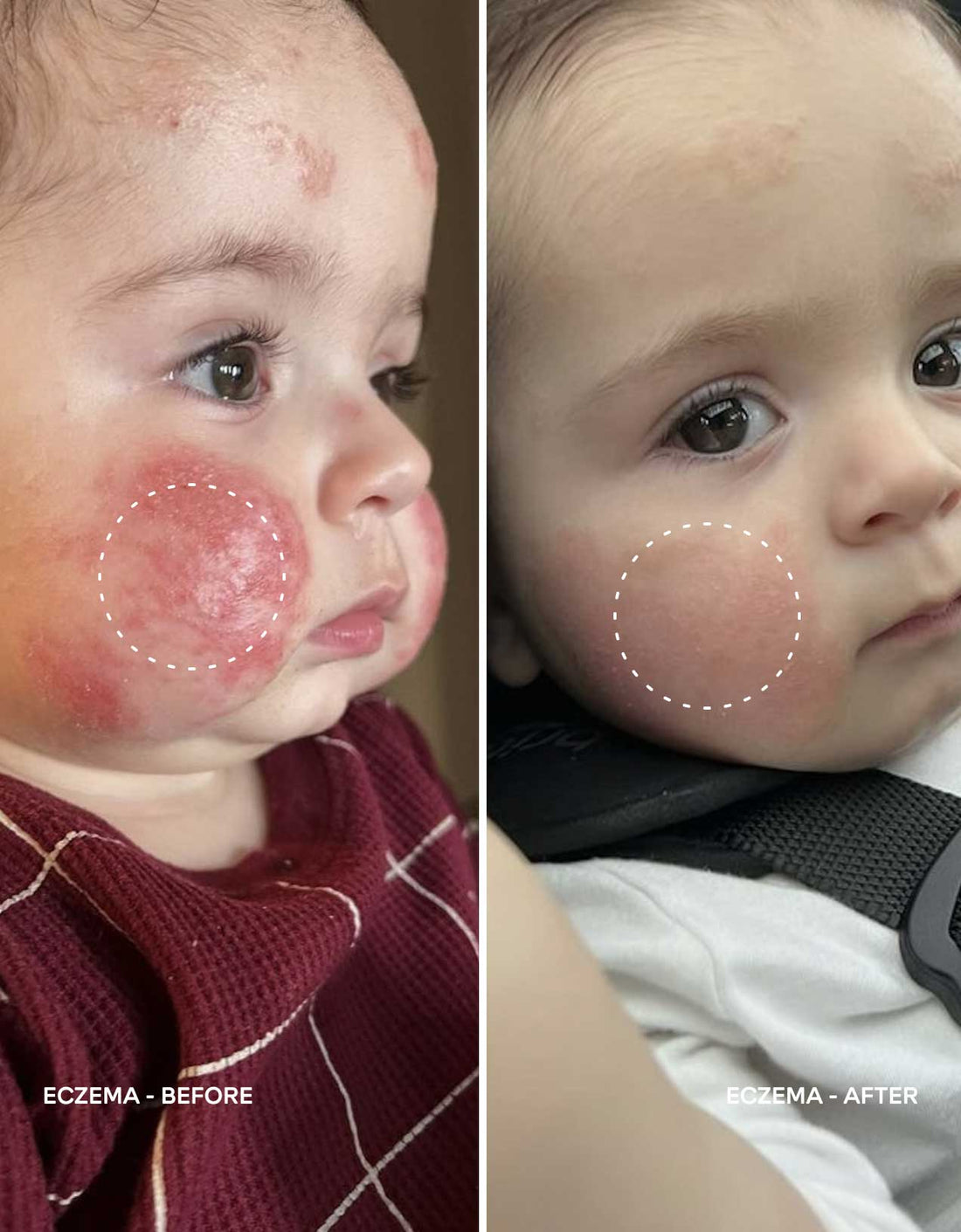 Magic Molecule | Hypochlorous Acid Solution