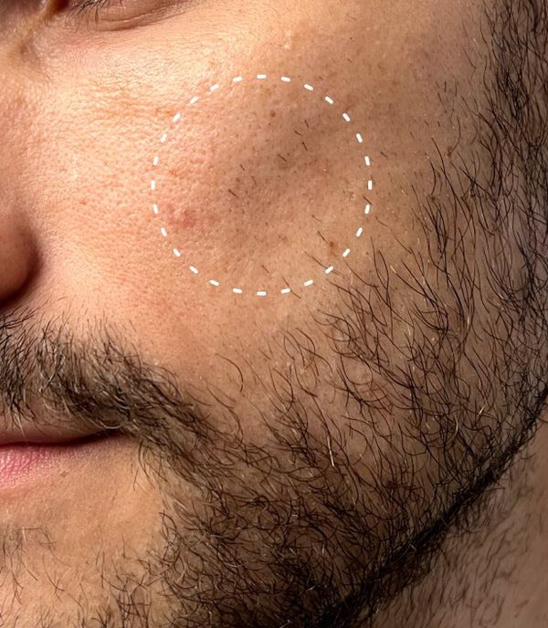 Magic Molecule | The magical all-over healing solution